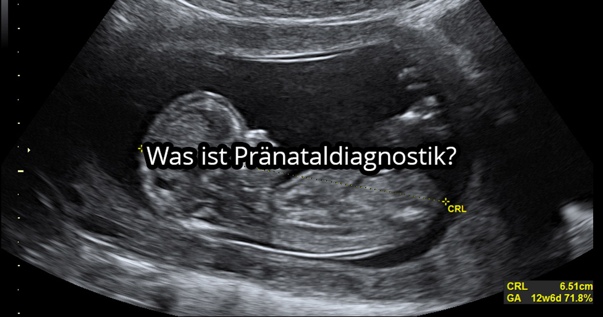 Was Sie über Pränataldiagnostik wissen sollten